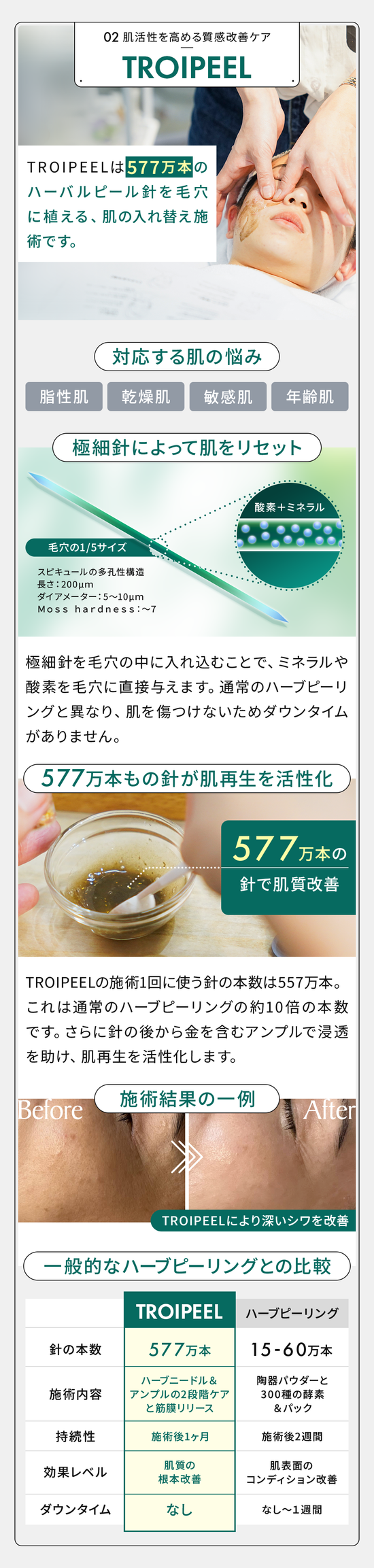 トロイアルケのサロンへの導入について – TROIAREUKE｜トロイアルケ